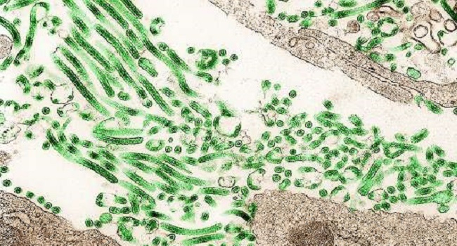 Cell First Image Of Ebola Virus Structure Its Relatives Obtained News Am Medicine All
